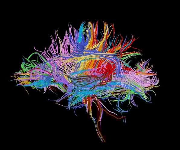 ¿Qué es la conectividad cerebral?